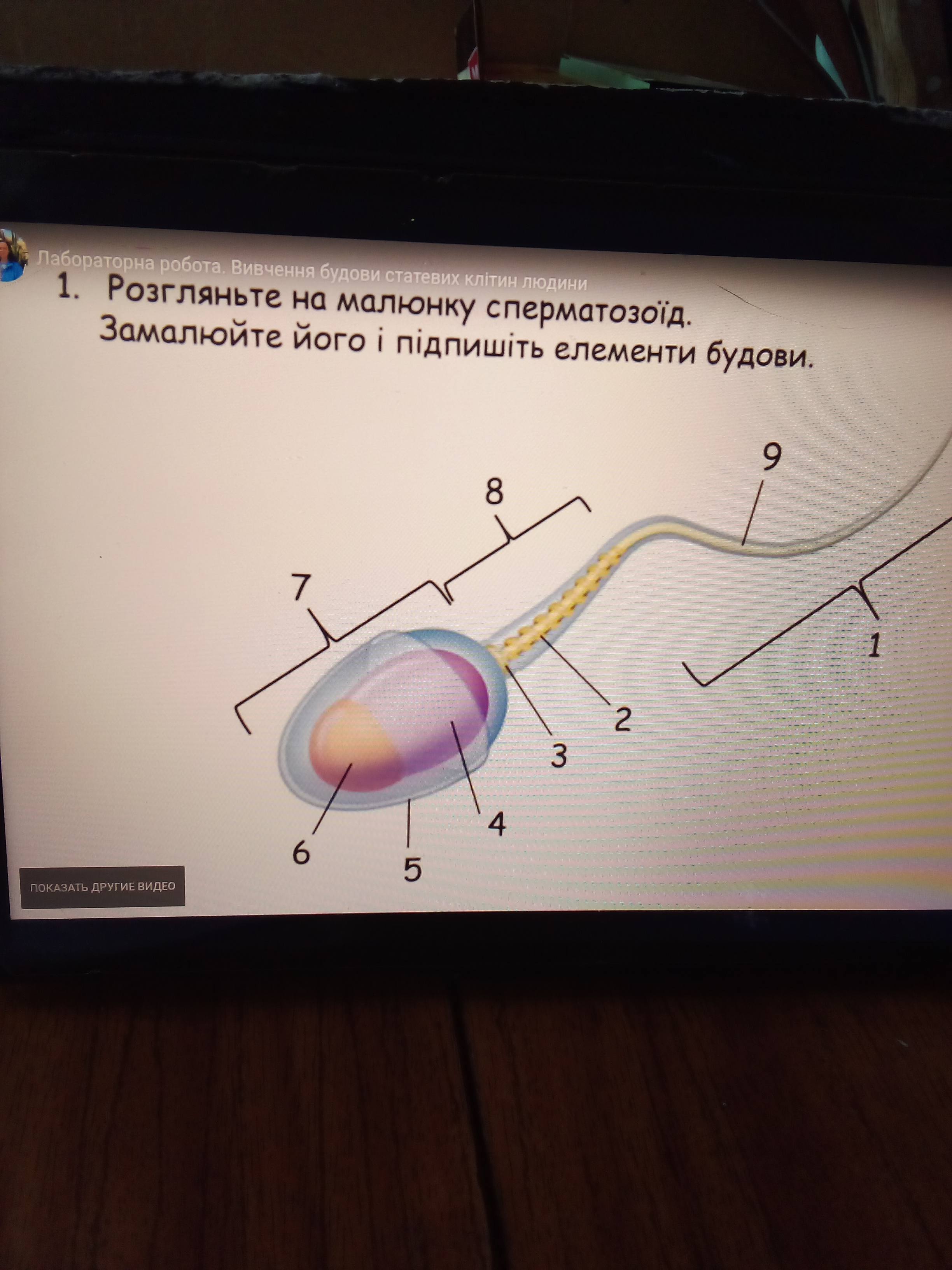 Identify and label the parts of the sperm cell in the image.